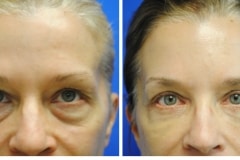 Face Gallery - Raj Plastic Surgery